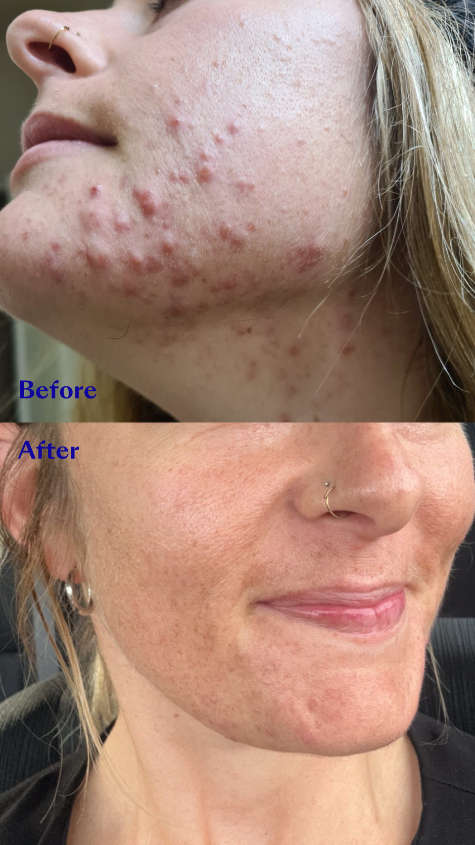 Buy Moisturiser - Vegan Natural Face Cream | Tailor Skin NZ – Tailor ...