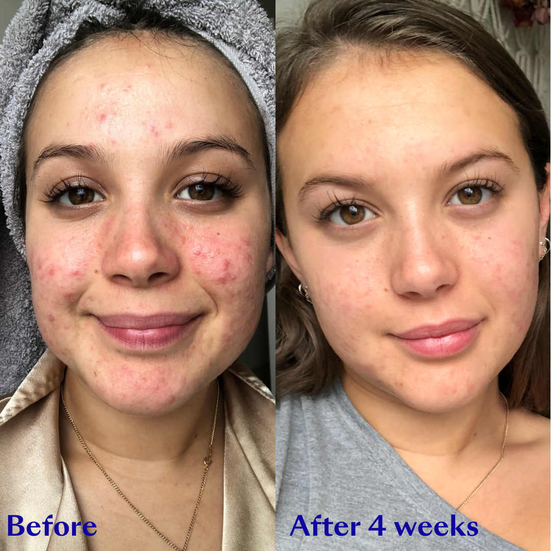 Buy Polish - Facial Mask & Scrub | Tailor Skin NZ – Tailor Skincare